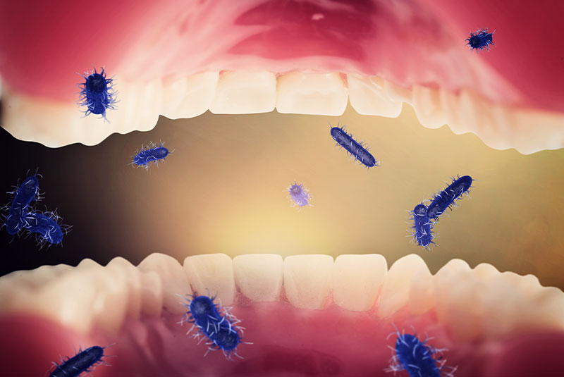 Antimicrobial Therapy for Gum Disease - Fort Lauderdale, FL